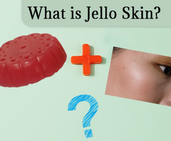 What is Jello Skin? | Modern Functional Health Medical Spa