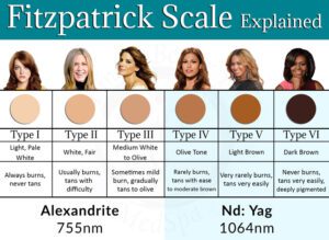 Free Fitzpatrick Scale Quiz | Find A Better You Med Spa